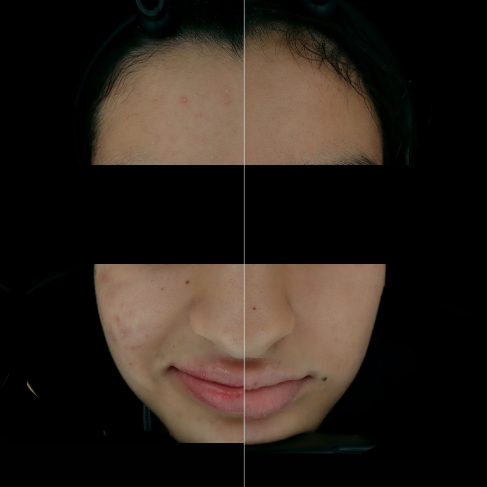 Cutis | Dermatología, piel sana para todos.